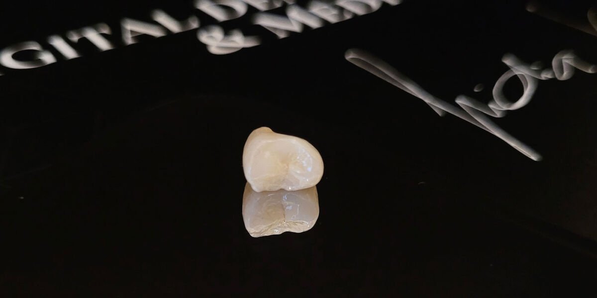 Korony full contour - Digital Dentistry & Medicine